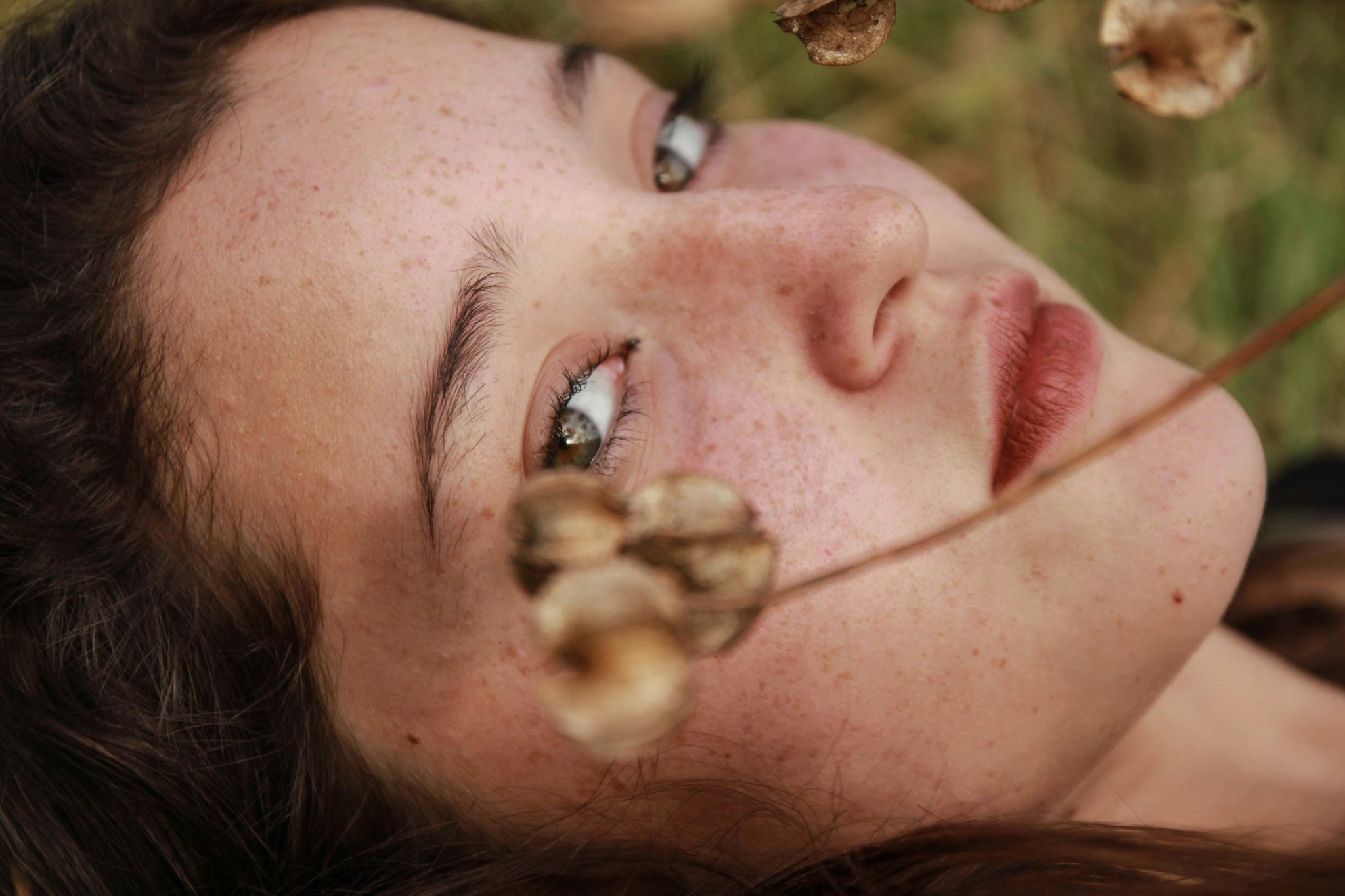 Acne Marks vs Acne Scars: Key Signs to Identify Each Condition